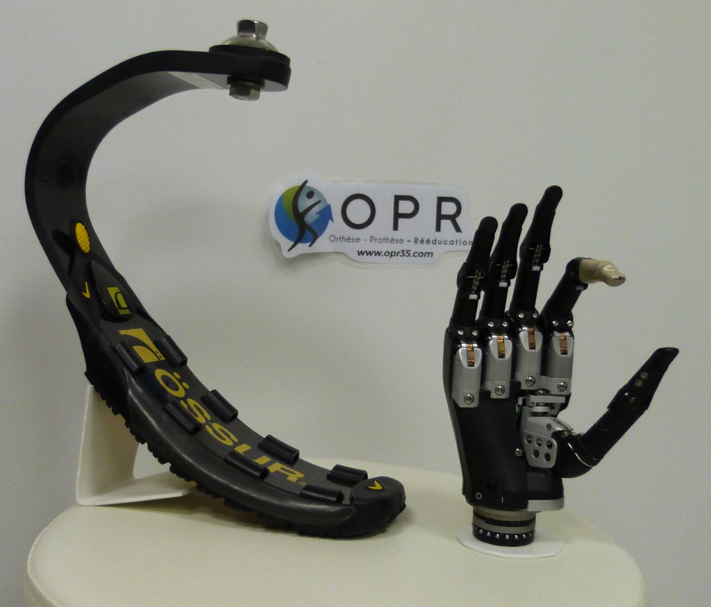 Essai I-limb Quantum et Flexrun pour un patient OPR Orthèse-Prothèse