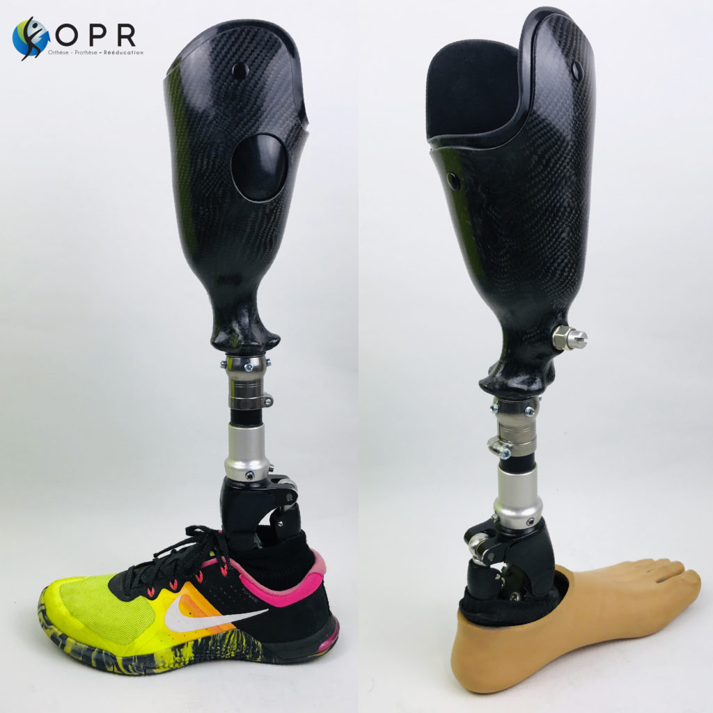 Prothèse tibiale en carbone avec double fut silicone : Rennes - Avranches