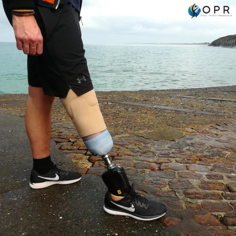 Prothèse tibiale, fabrication et adaptation : OPR Bretagne & Normandie