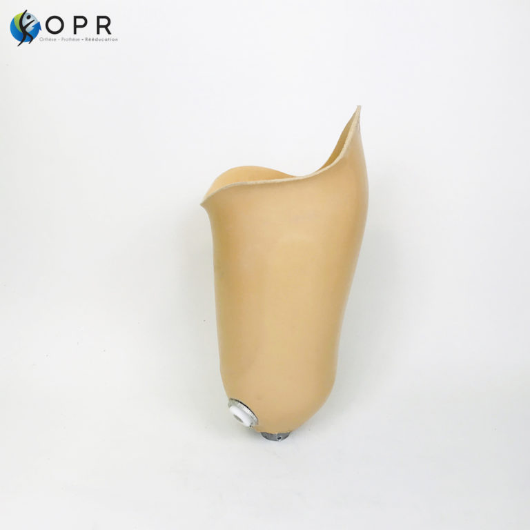 Emboîture de prothèse fémorale souple Prothésiste Bretagne - Normandie