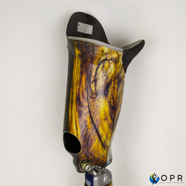 Prothèse carbone avec esthétique bois : Saint-Lô - Rennes - Avranches