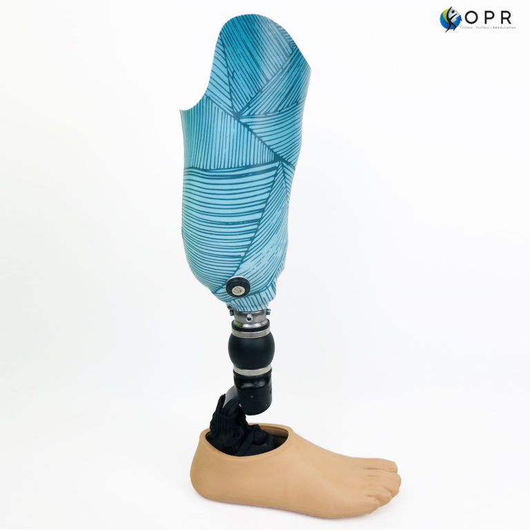 Prothèse tibiale, fabrication et adaptation : OPR Bretagne & Normandie