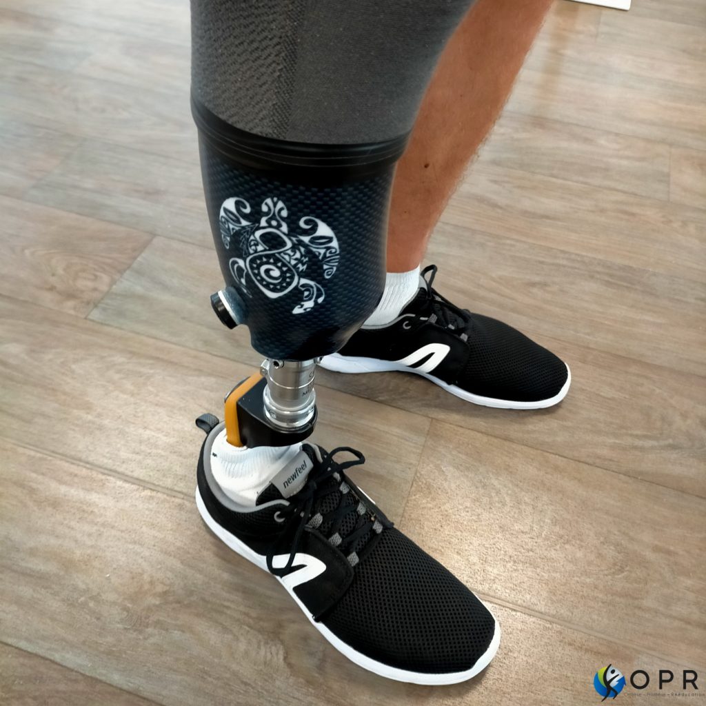 Prothèse tibiale personnalisée sur demande ! OPR Bretagne & Normandie