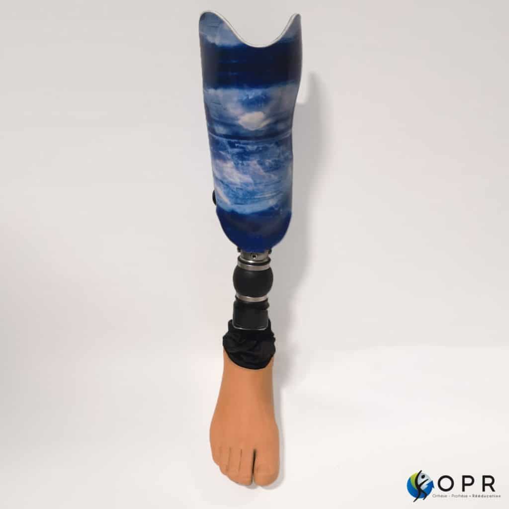 Prothèse tibiale au motif océan ! | OPR : Orthèse Prothèse Rééducation