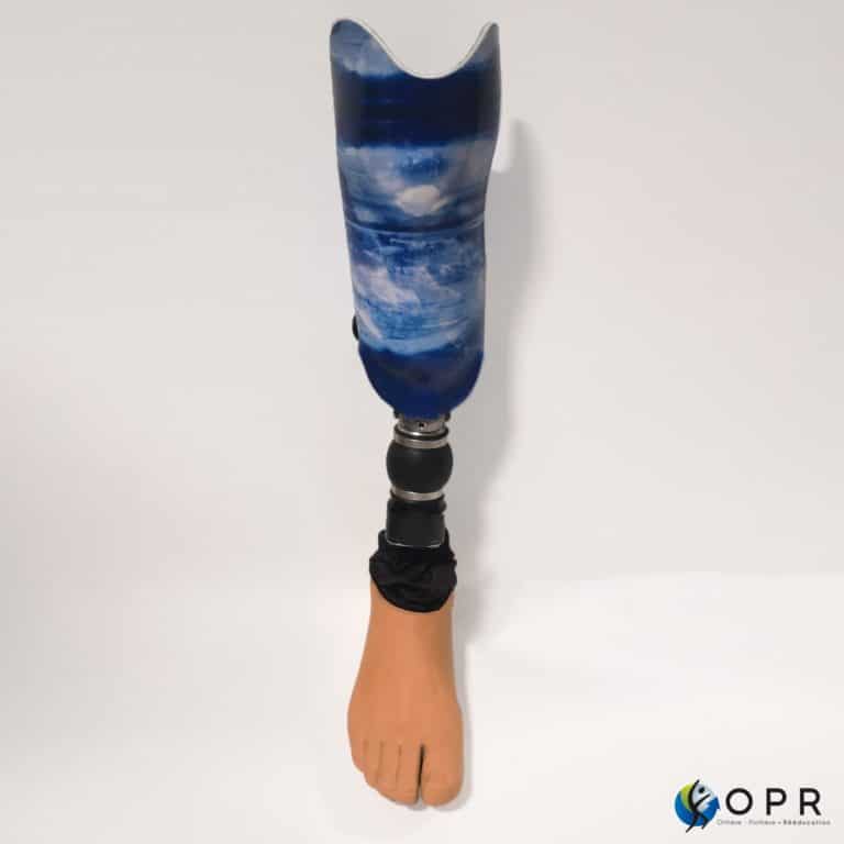 Prothèse tibiale, fabrication et adaptation : OPR Bretagne & Normandie