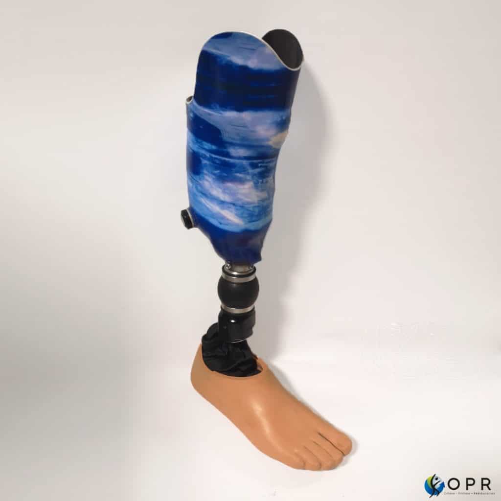 Prothèse tibiale au motif océan ! | OPR : Orthèse Prothèse Rééducation