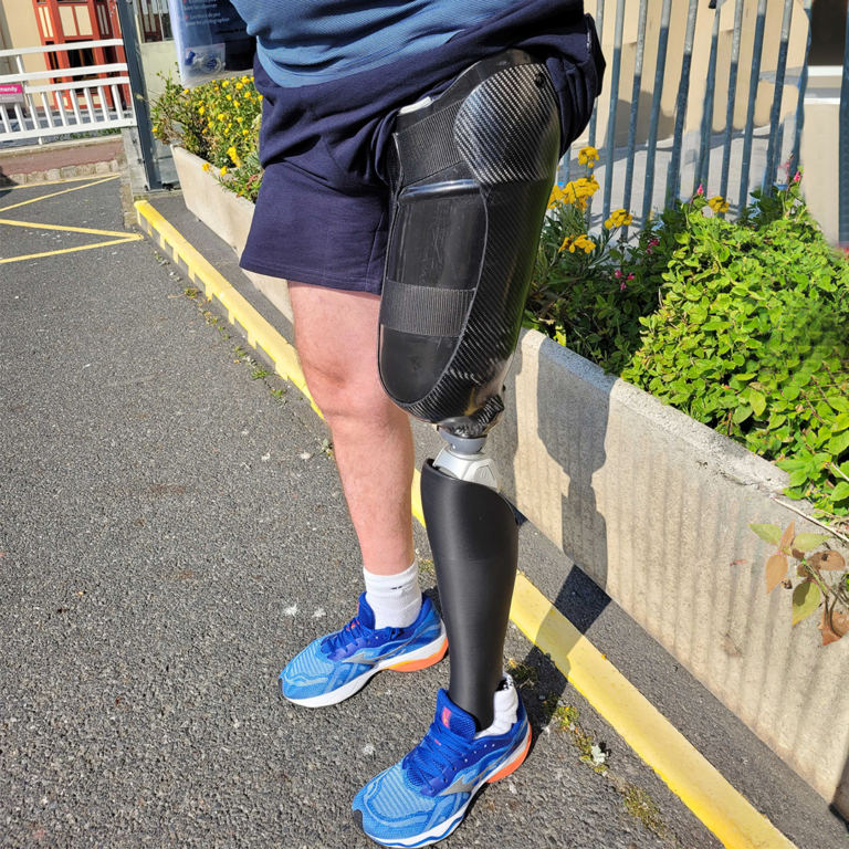 prothese-femorale-jambe-gauche | OPR : Orthèse Prothèse Rééducation
