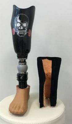 Prothèse tibiale, fabrication et adaptation : OPR Bretagne & Normandie